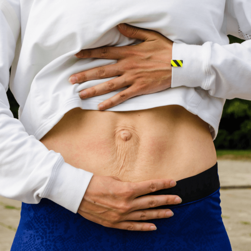 MumSafe™ | Abdominal Separation - What It Is and What You Can Do About ...
